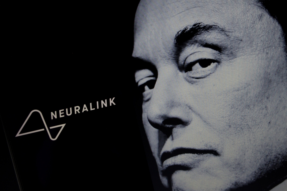 Neuralink plant, große Gehirnimplantate herzustellen und die ...